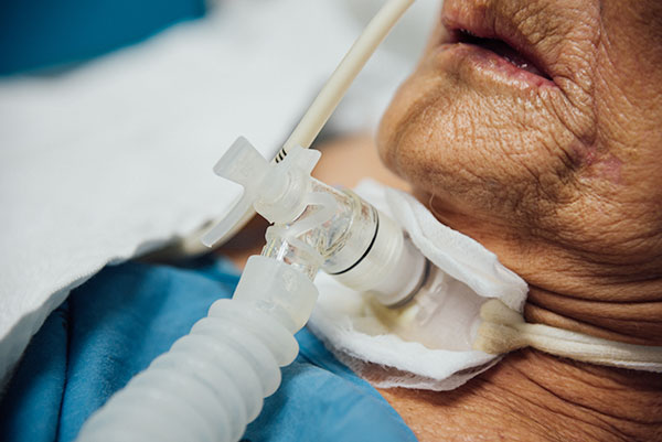 What are the 10 main precautions for safer suction catheter use ...